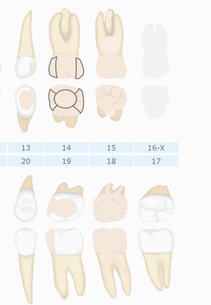 Auto-Chart to PMS – Denti.AI